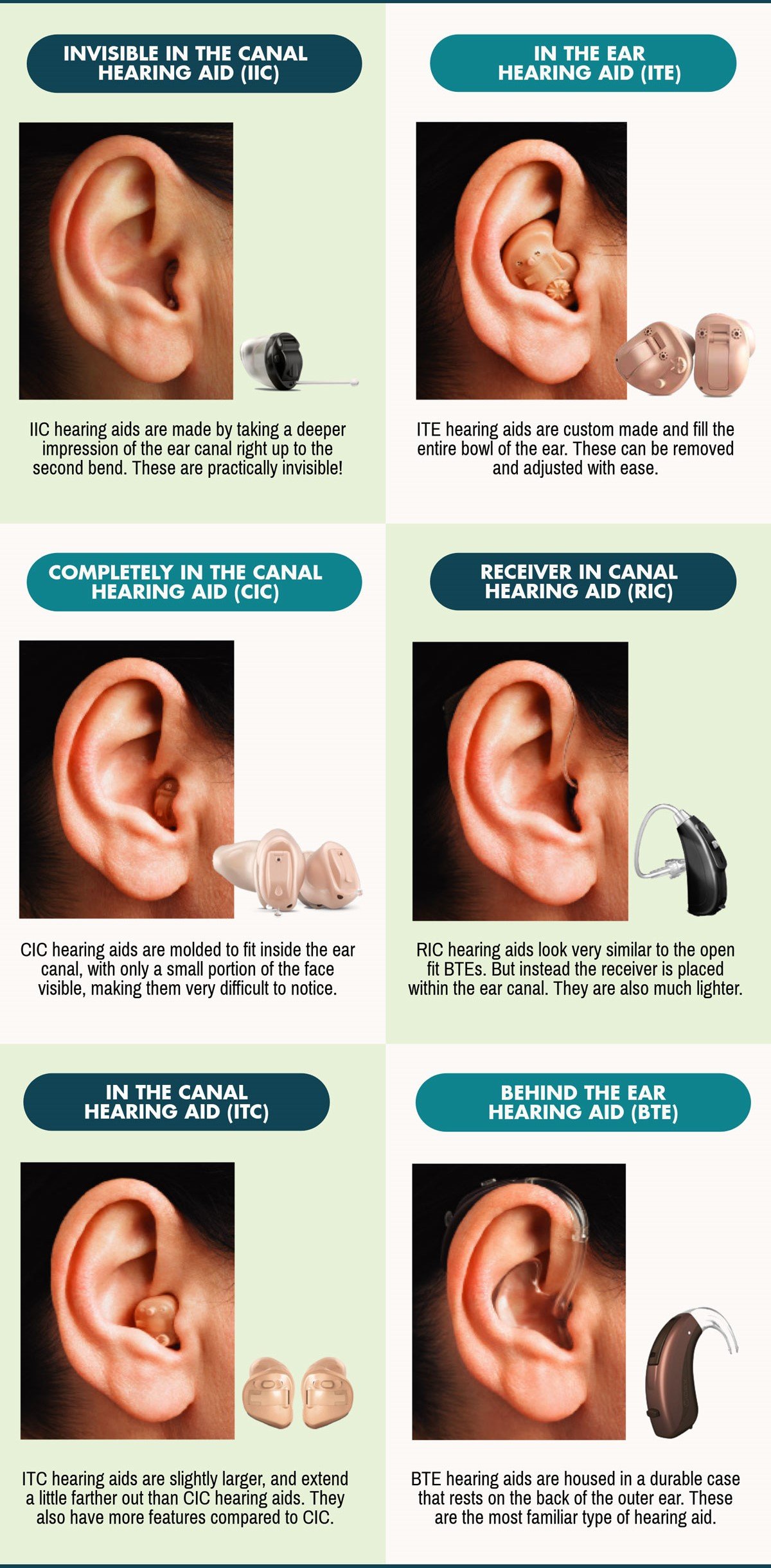 HEARING AID - Things to know before buying Hearing Aid